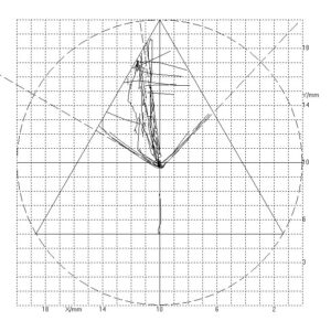Kiefergelenksdiagnostik DIR® SYSTEM | mundum Zahnarzt Köln